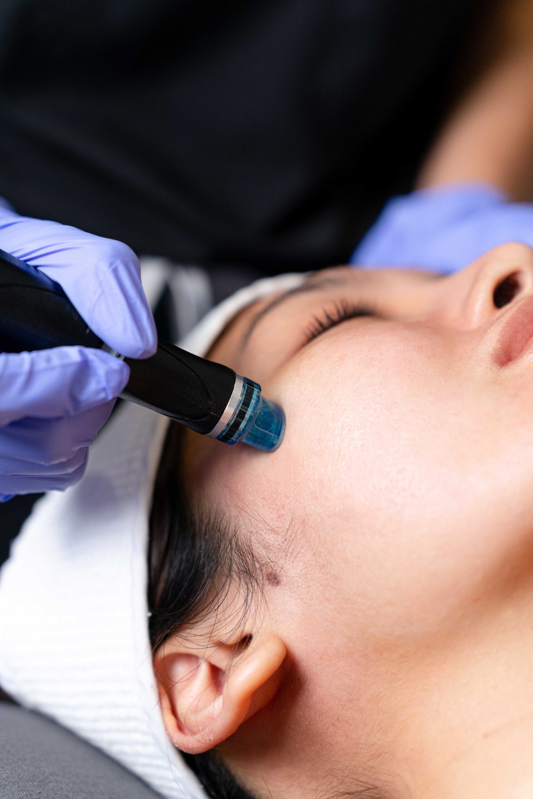 Hydrafacial: Signature - Zionne Beauty Lounge